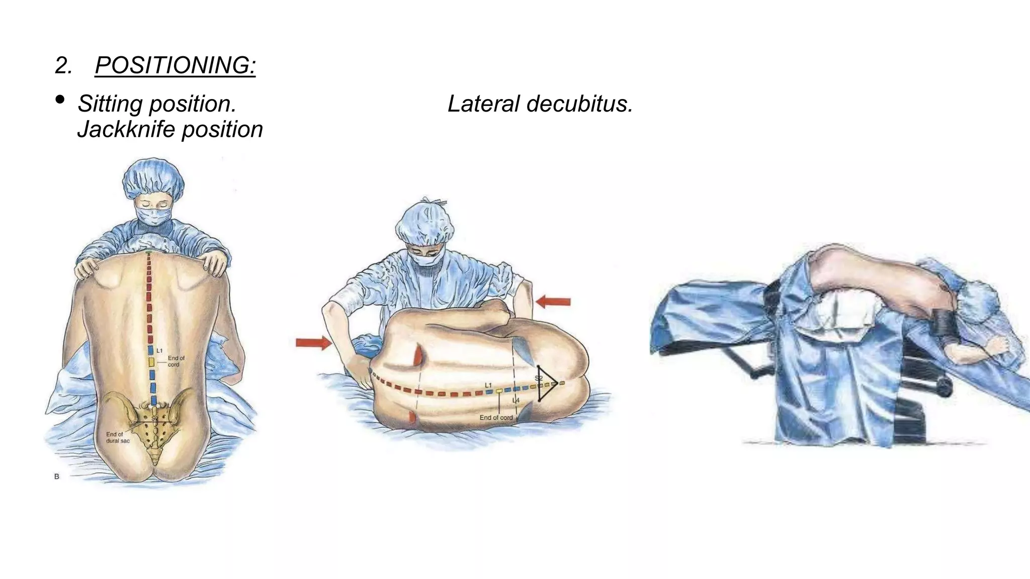Spinal anaesthesia(1).pptx