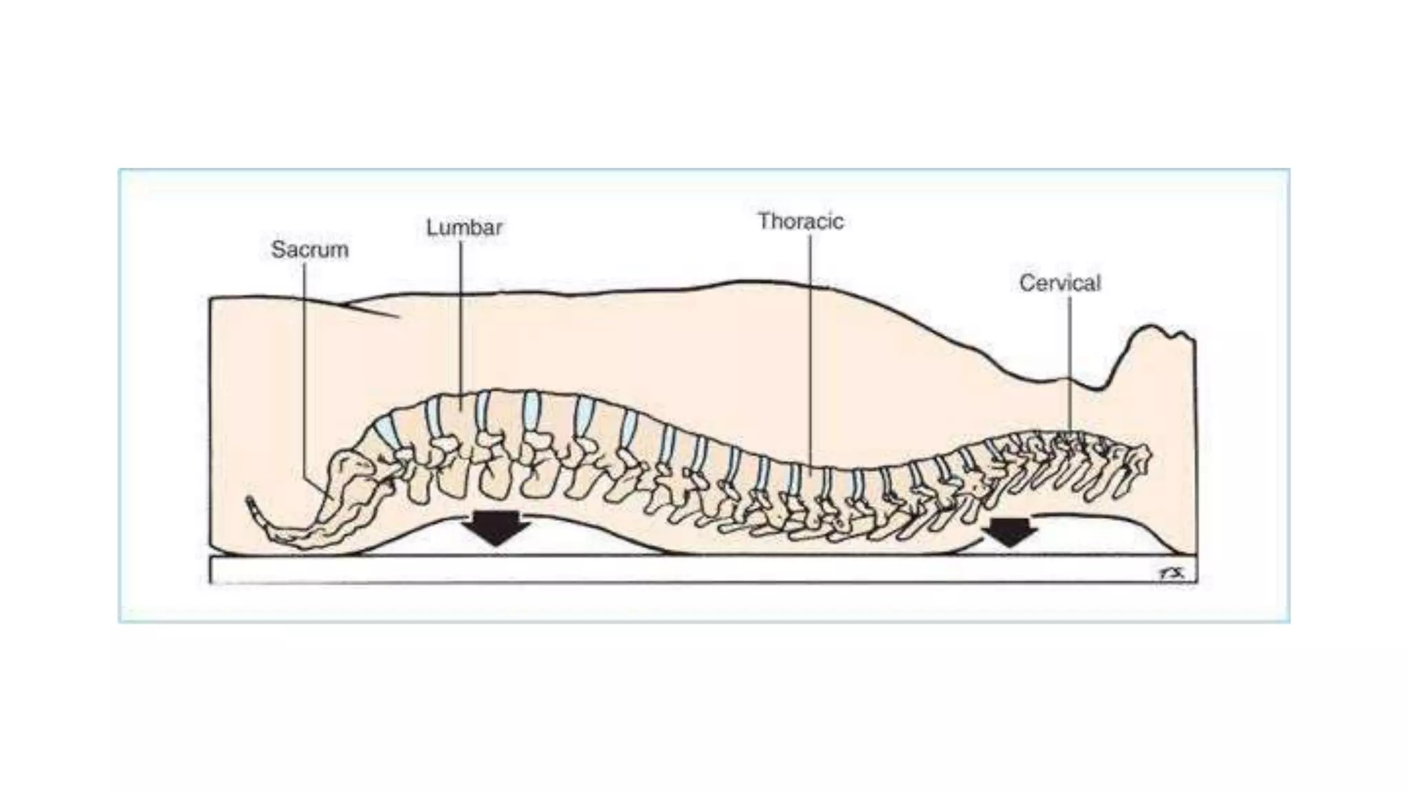 Spinal anaesthesia(1).pptx