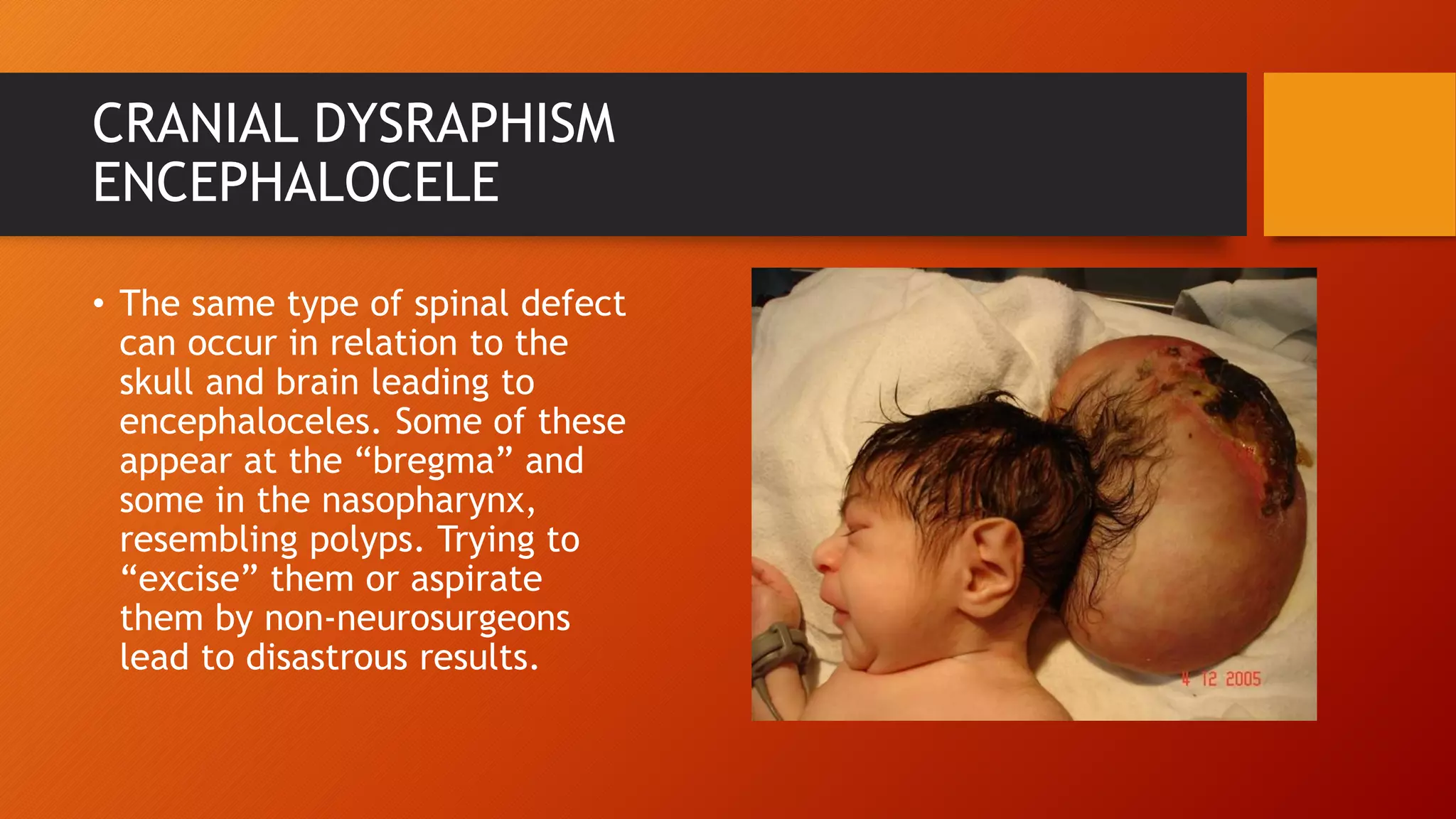 I LOVE NEUROSURGERY INITIATIVE: SPINAL AND CRANIAL DYSRAPHISM.pptx