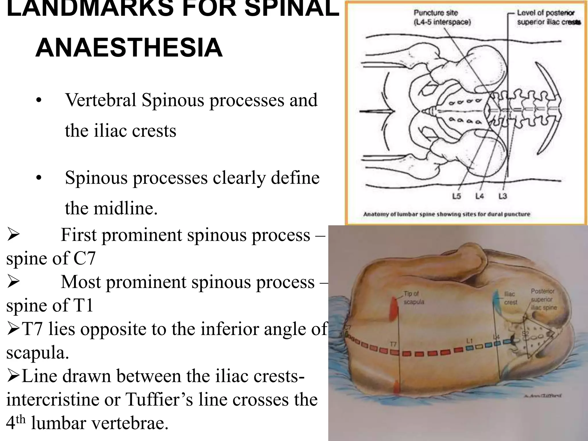 Spinal and Epidural Anaesthesia.pptx