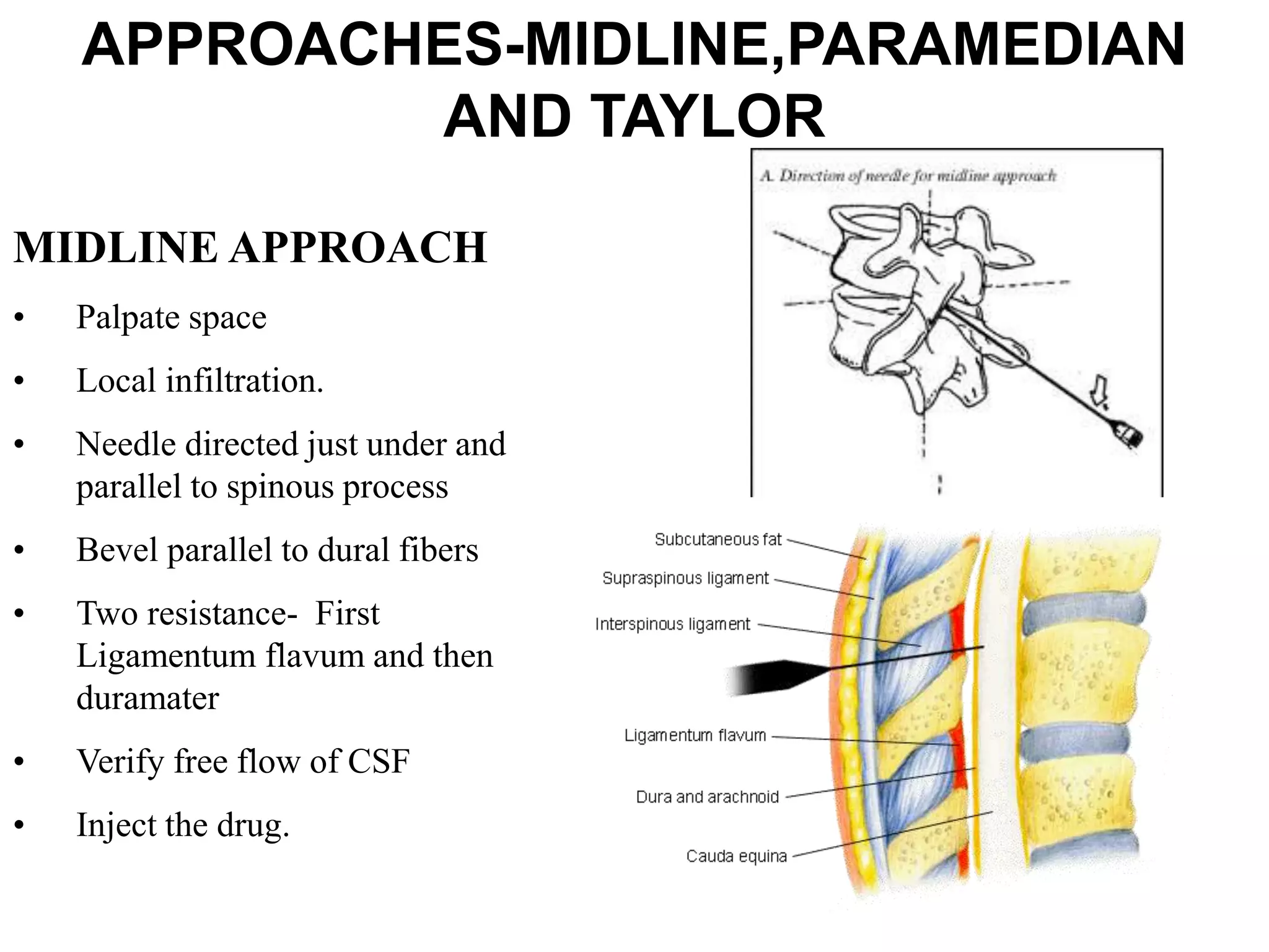 Spinal and Epidural Anaesthesia.pptx