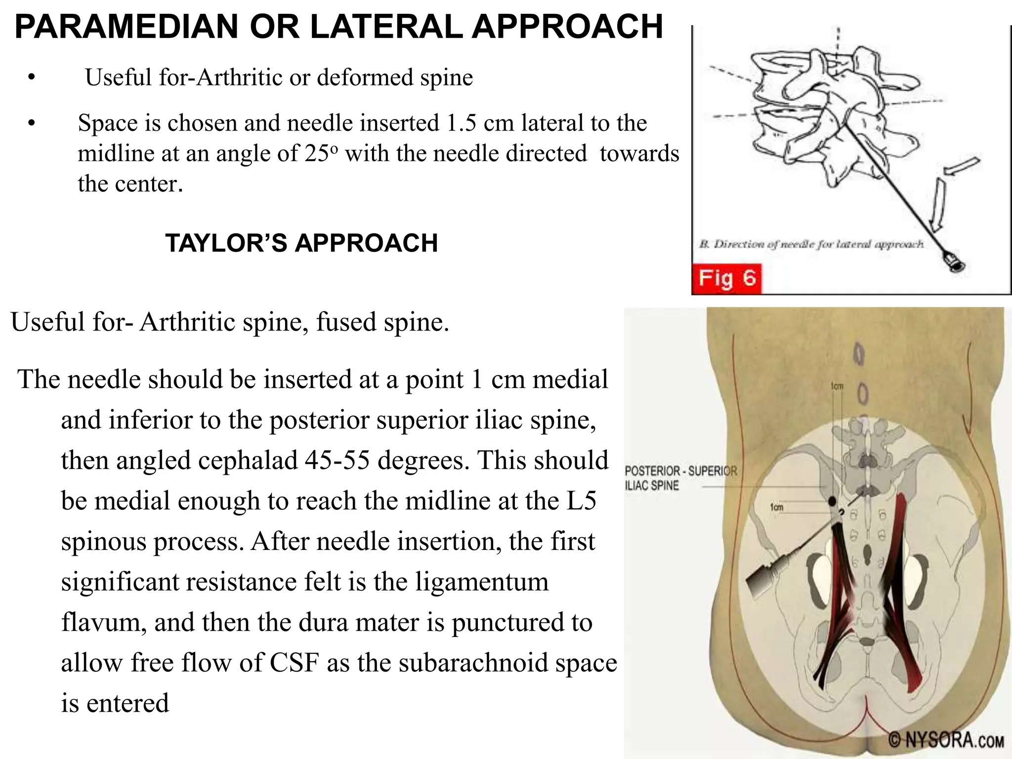 Spinal and Epidural Anaesthesia.pptx
