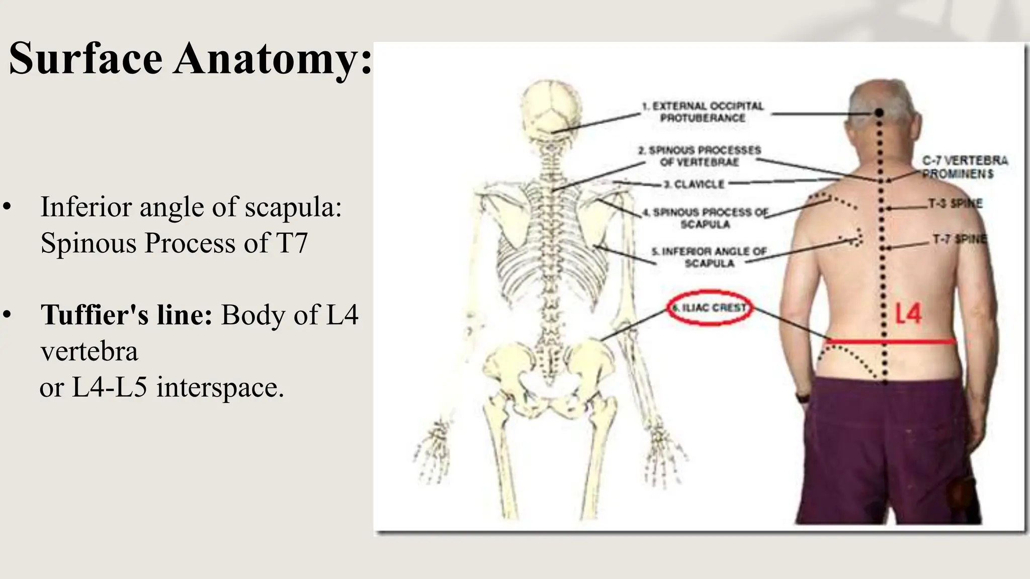 Spinal and Epidural Anaesthesia 5 1.pptx