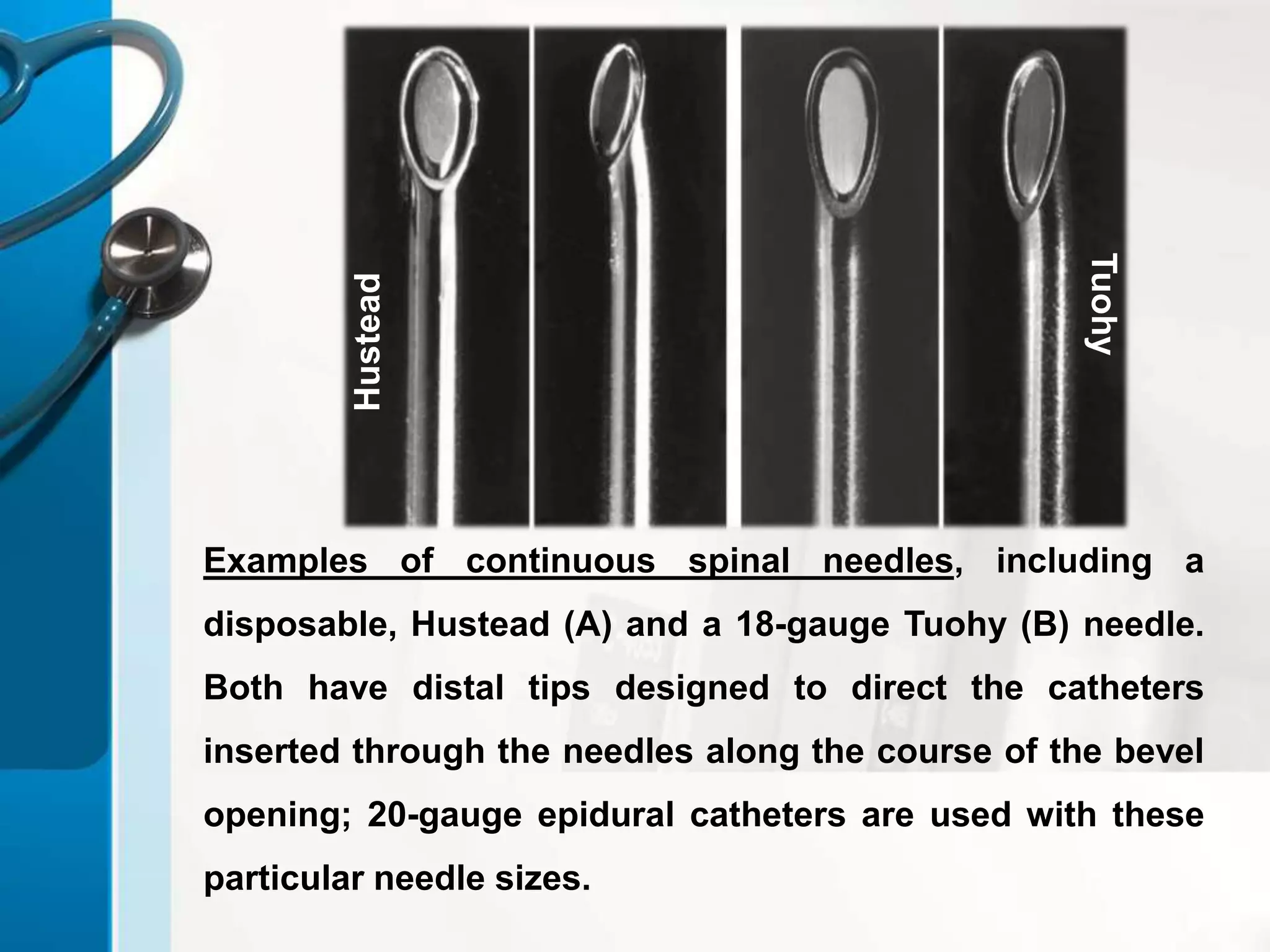 SPINAL AND EPIDURAL ANESTHEISA by Dr.Sravani Vishnubhatla | PPTX