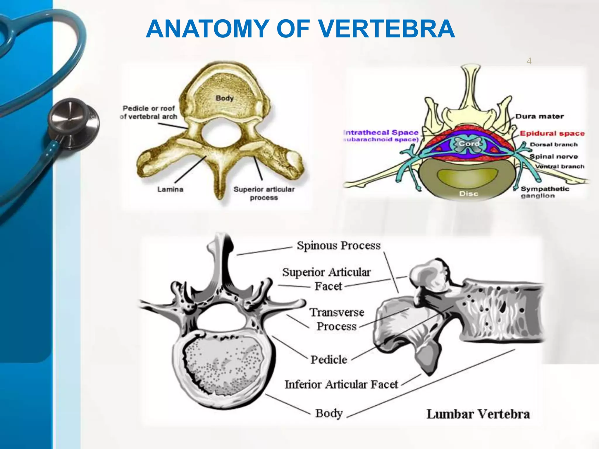 SPINAL AND EPIDURAL ANESTHEISA by Dr.Sravani Vishnubhatla | PPTX