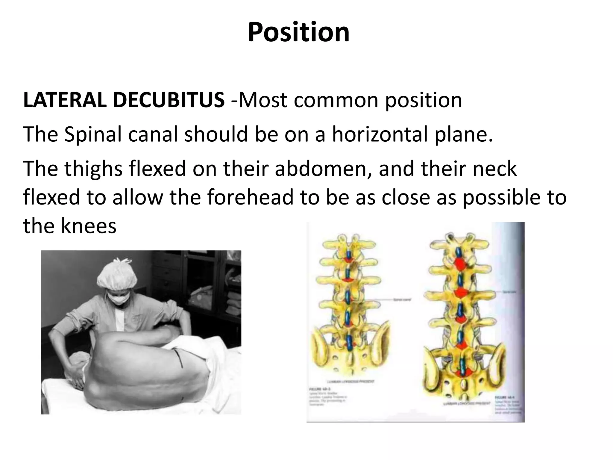 Spinal anesthesia | PPTX | First Aid | Injuries