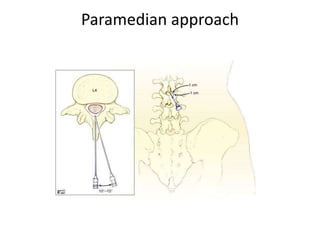 Spinal anesthesia | PPTX