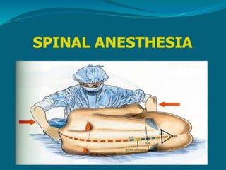 Spinal anesthesia | PPTX