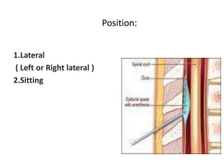 Spinal anesthesia | PPTX