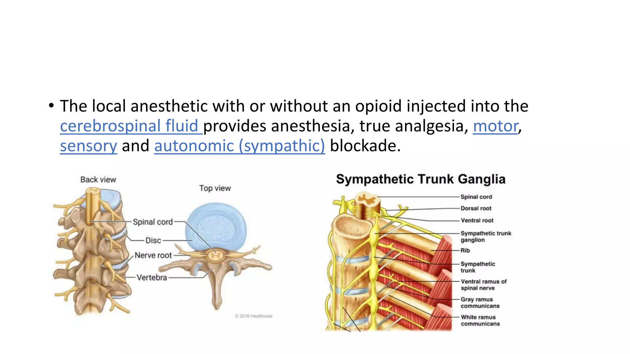 spinal anesthesia | PPT