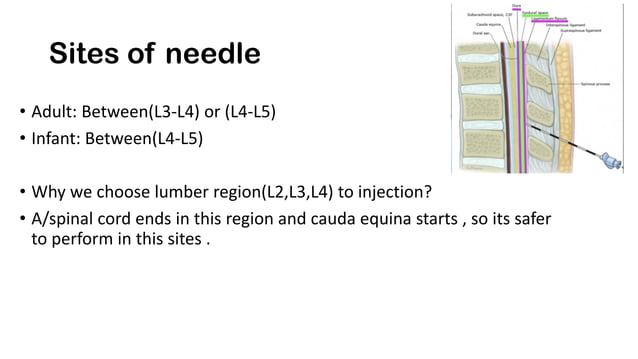 spinal anesthesia | PPT