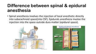 spinal anesthesia | PPT