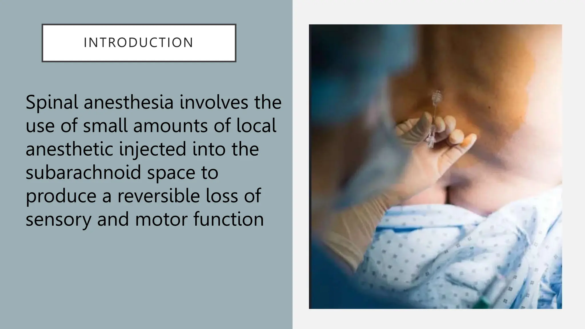 SPINAL ANESTHESIA by DR NIKHIL VORUGANTI | PPTX