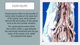 SPINAL ANESTHESIA by DR NIKHIL VORUGANTI | PPTX