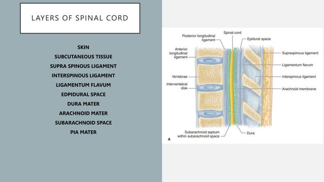 SPINAL ANESTHESIA by DR NIKHIL VORUGANTI | PPT