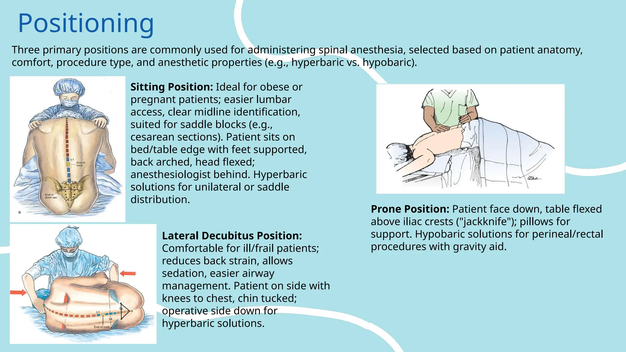 Spinal Anesthesia used in operations.pptx