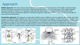 Spinal Anesthesia used in operations.pptx