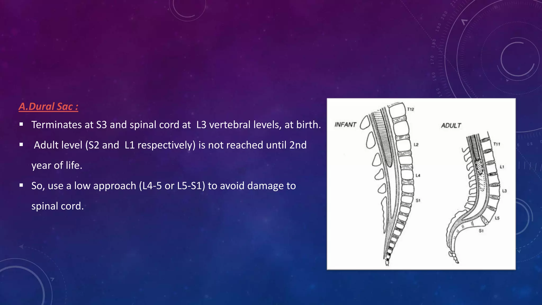 Spinal anesthesia in childeren | PPTX