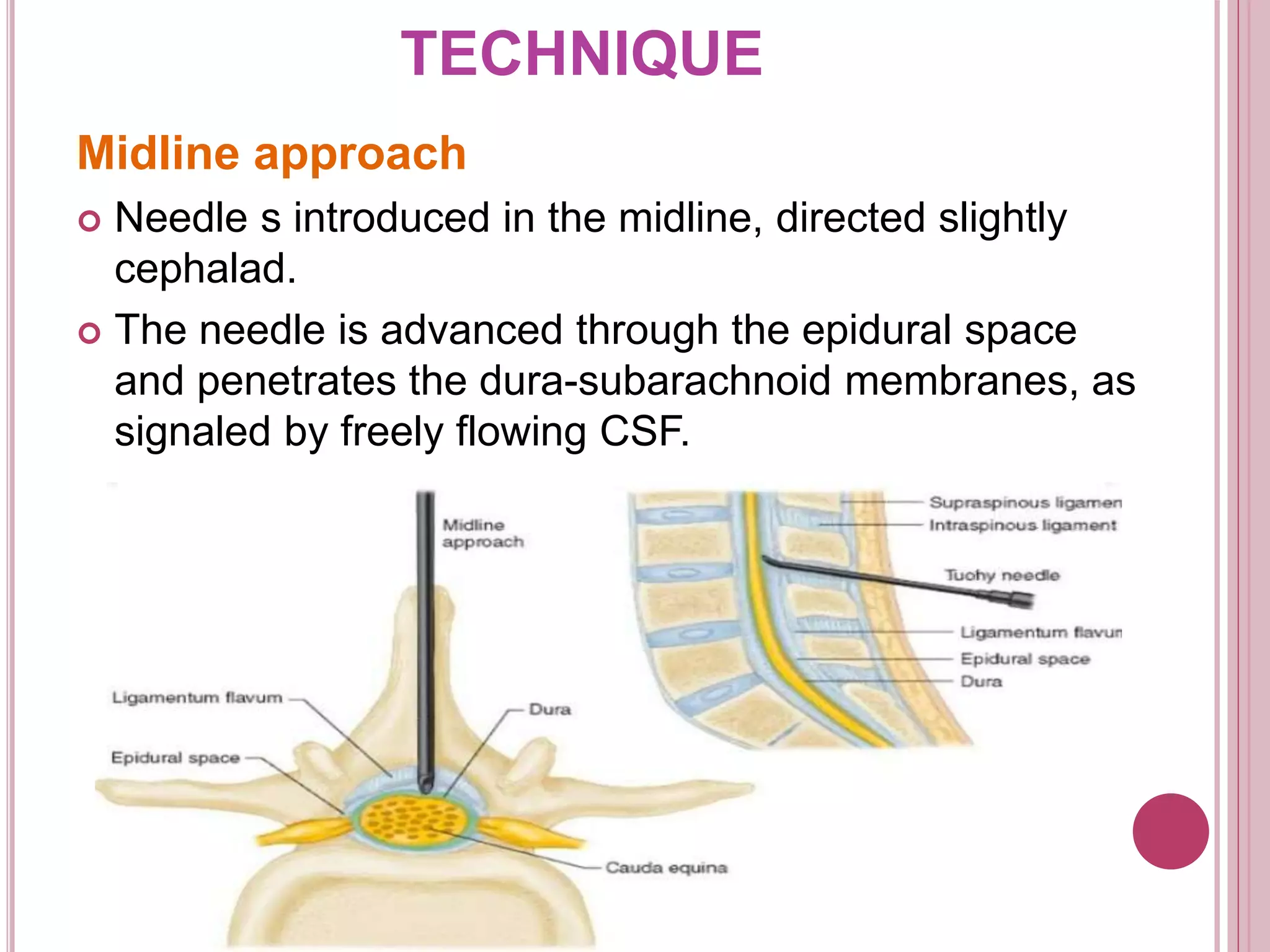 Spinal anesthesia slides | PPTX