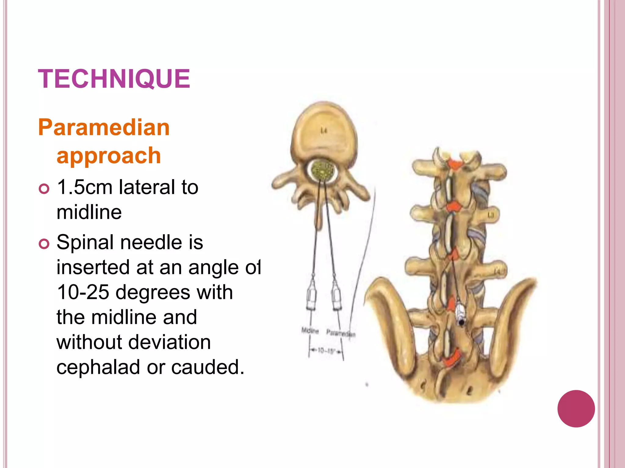 Spinal anesthesia slides | PPTX