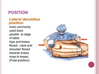 Spinal anesthesia slides | PPTX
