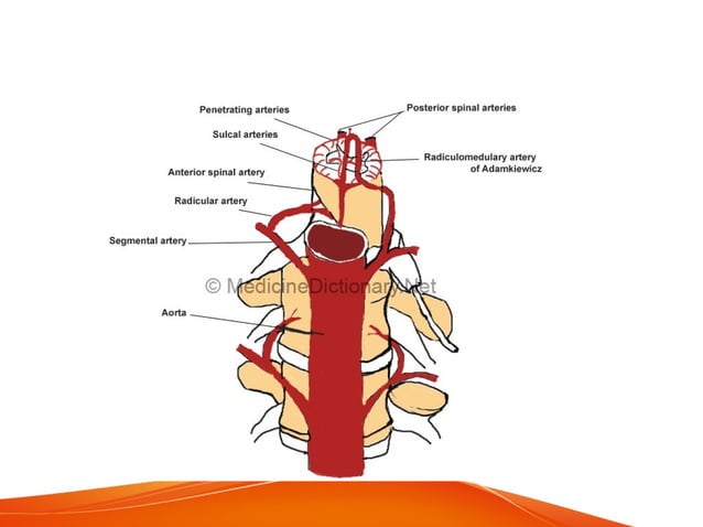 Spinal arteriovenous malformations | PPT