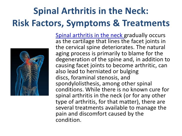 Spinal Arthritis Neck