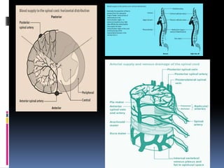 Spinal AVM AIIMS.pptx
