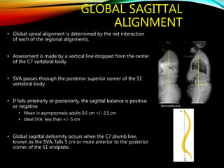 Spinal balance | PPTX