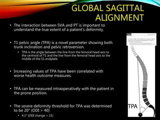 Spinal balance | PPTX
