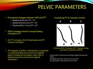 Spinal balance | PPTX