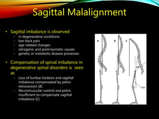 Spinal balance | PPTX