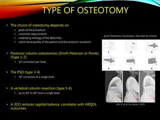 Spinal balance | PPTX