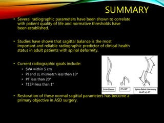 Spinal balance | PPTX