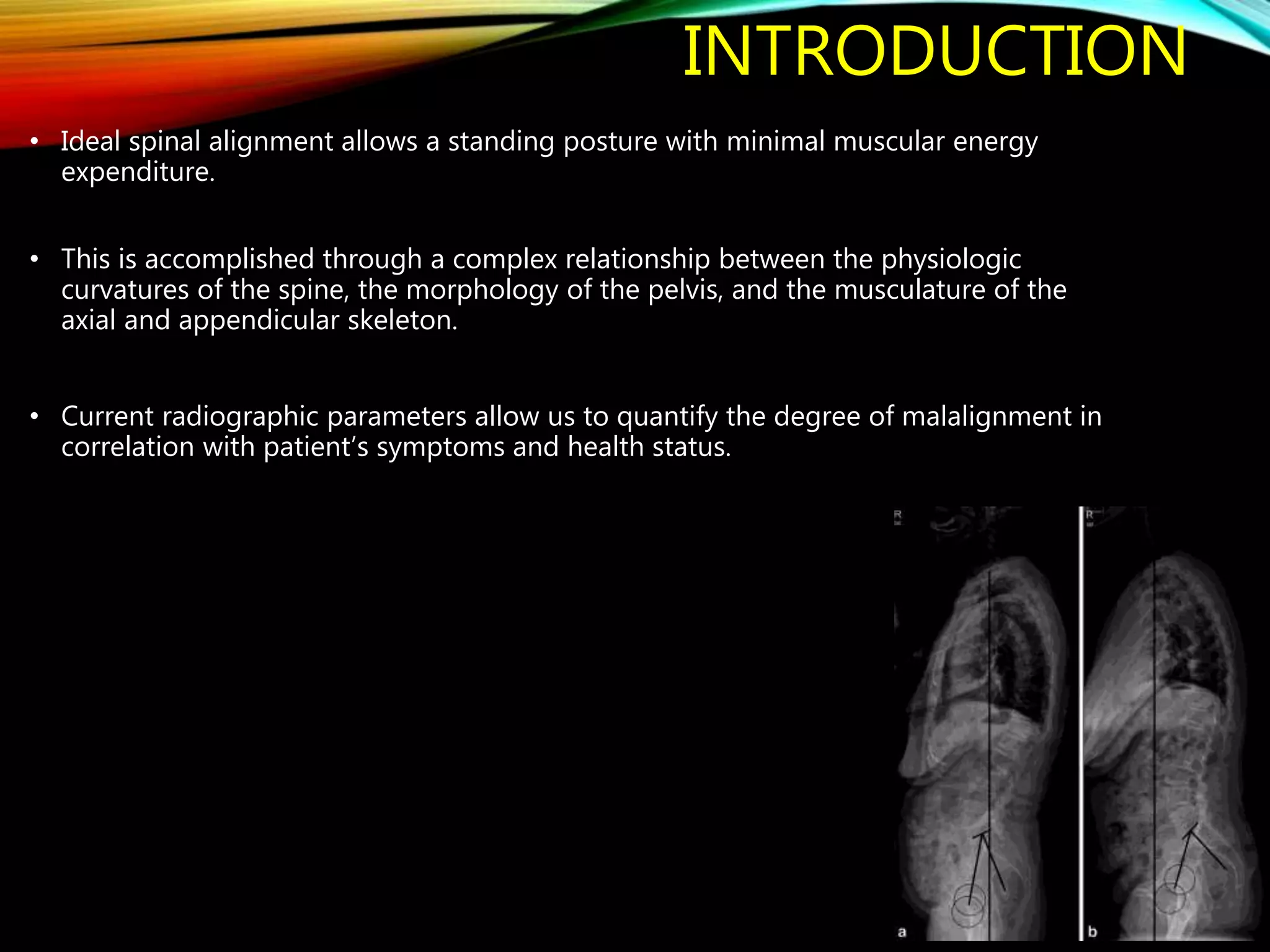 Spinal balance ras | PPTX