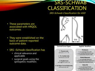 Spinal balance ras | PPTX