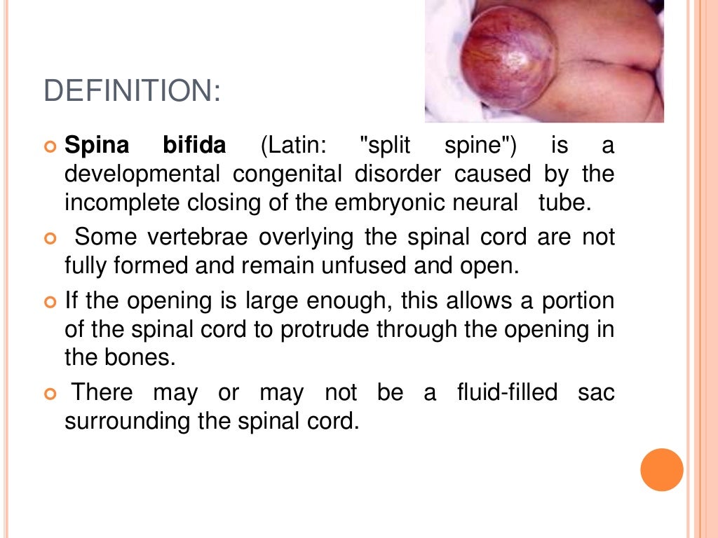 Spinal bifida