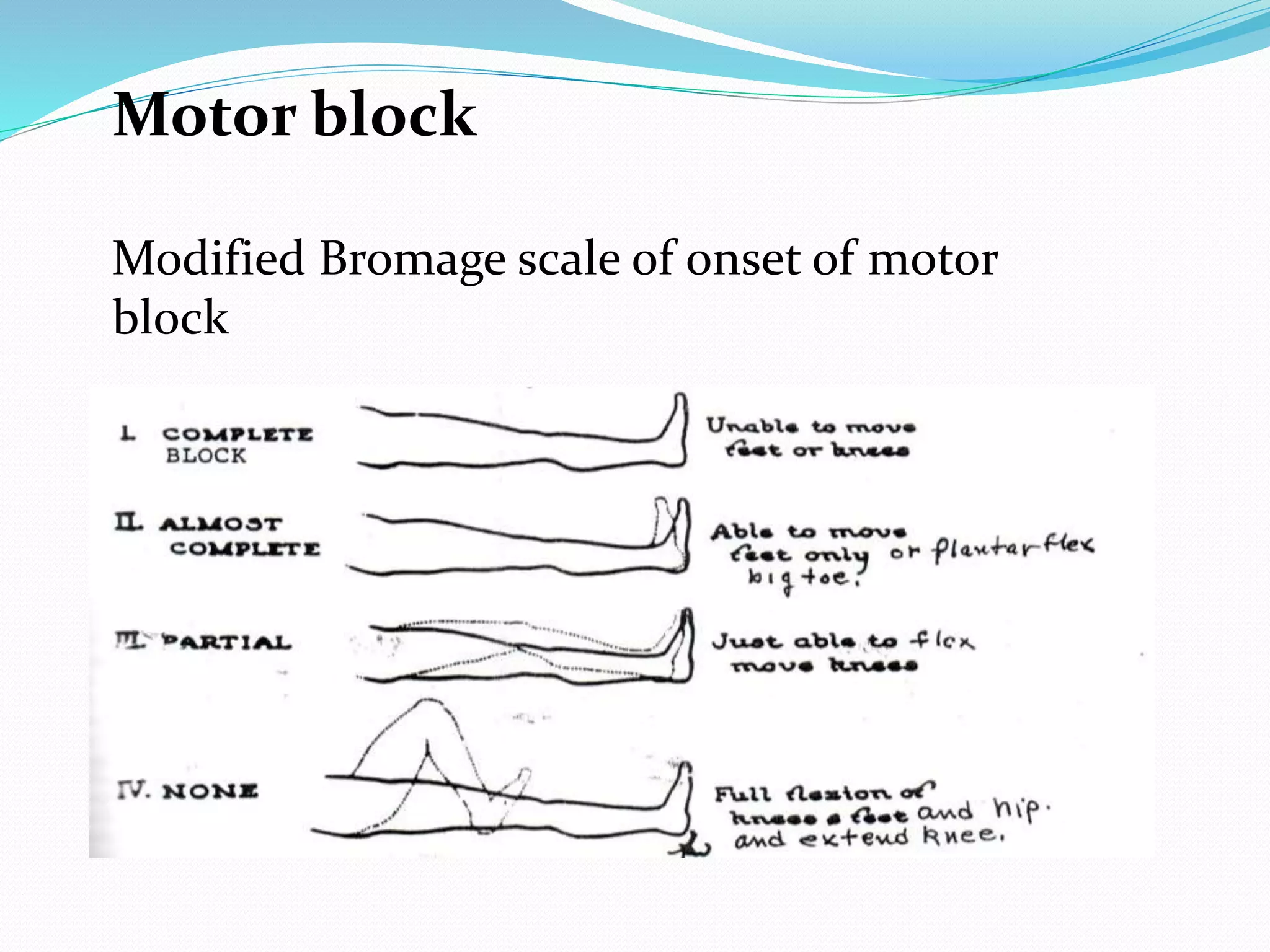 Spinal block | PPTX | First Aid | Injuries