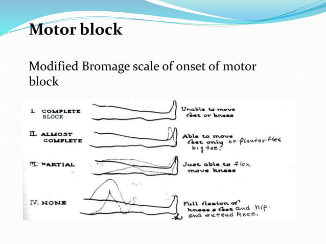 Spinal block | PPTX | First Aid | Injuries