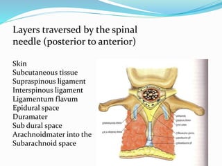 Spinal Block