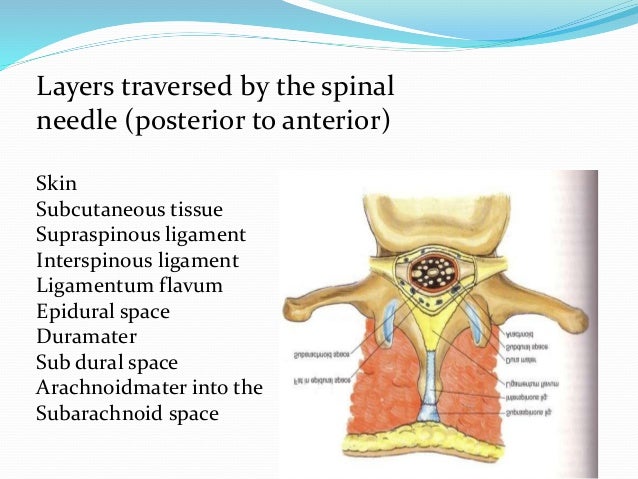 Spinal block