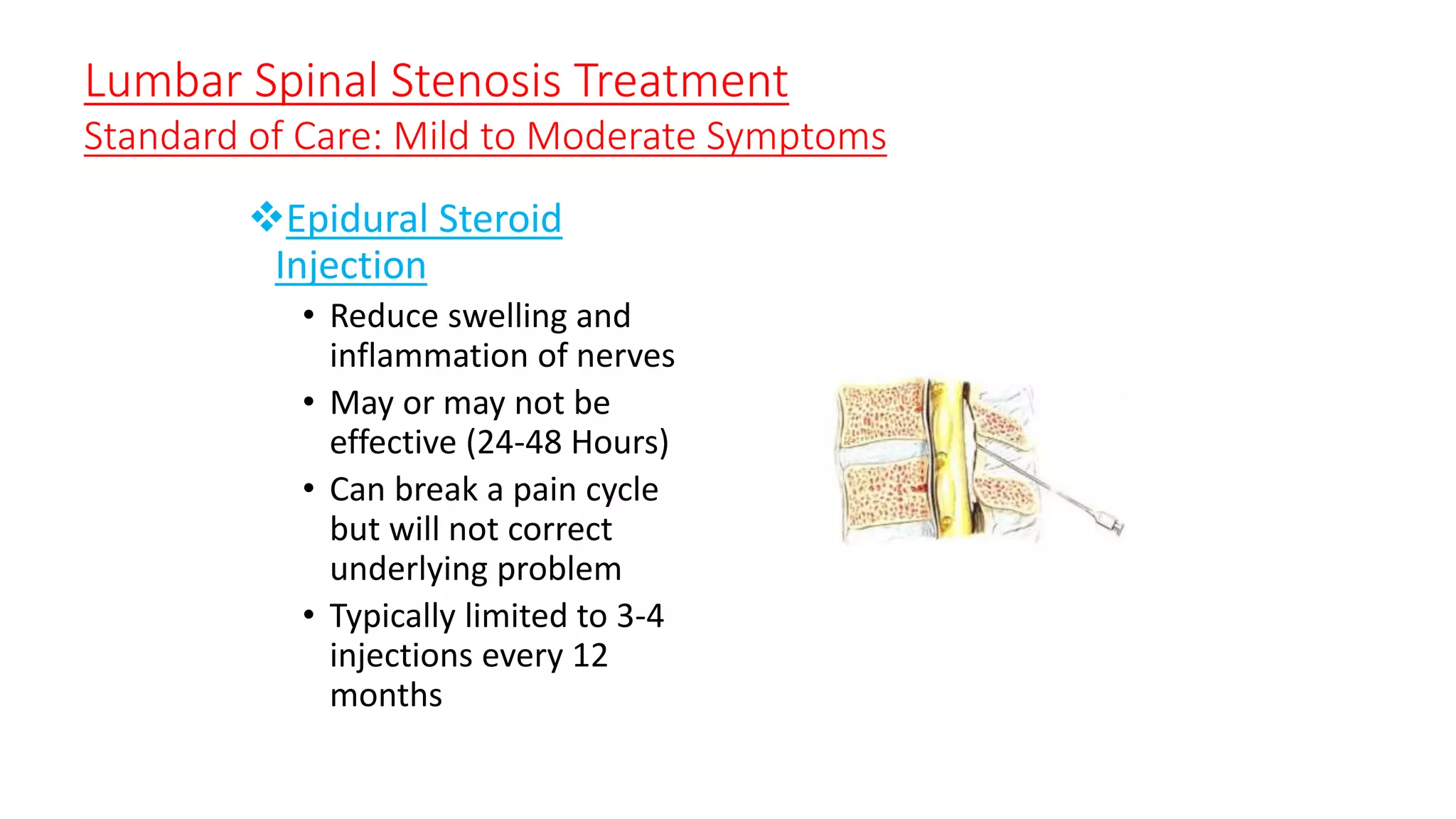 Spinal canal stenosis | PPTX