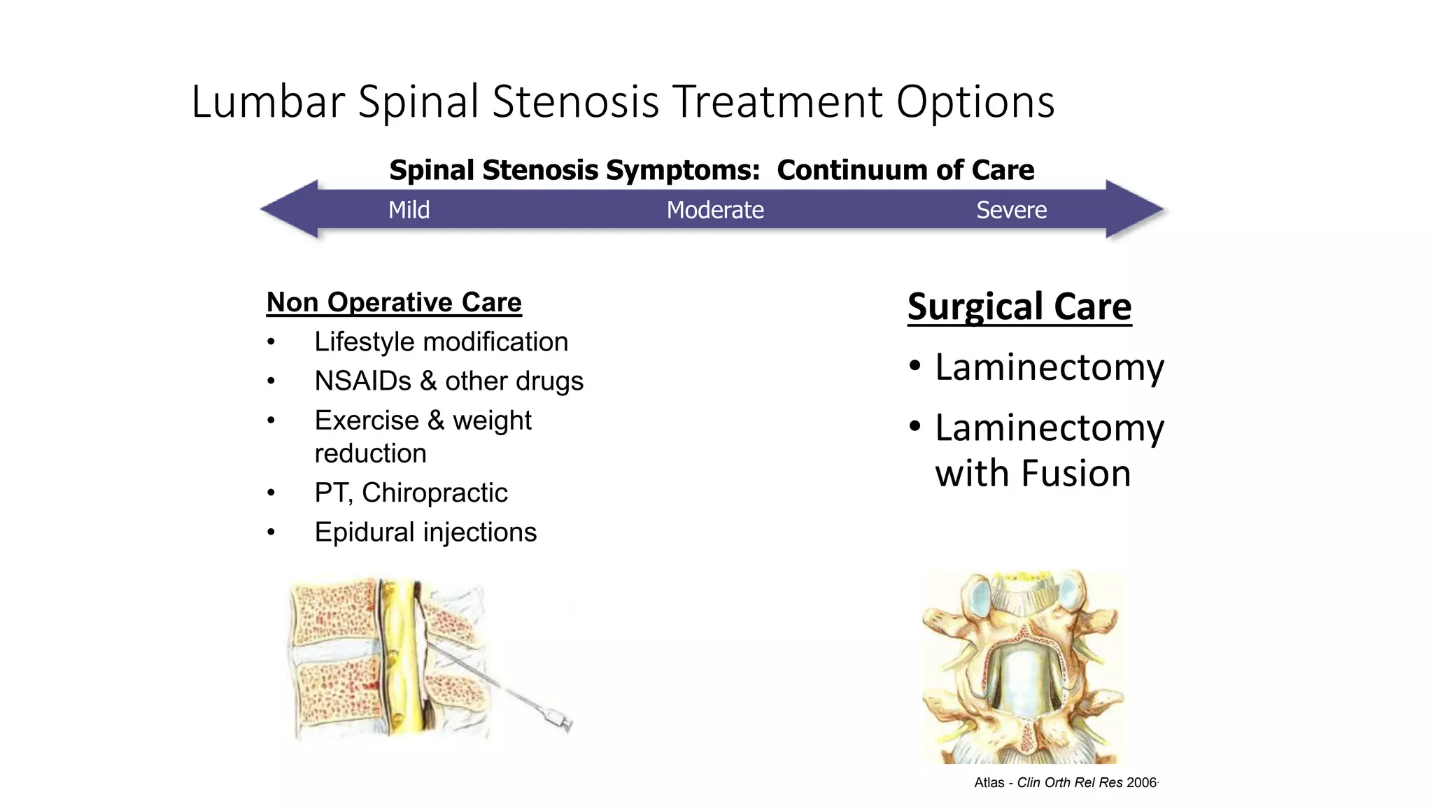 Spinal canal stenosis | PPTX