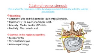 Spinal canal stenosis | PPTX
