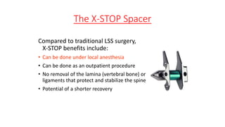 Spinal canal stenosis | PPTX
