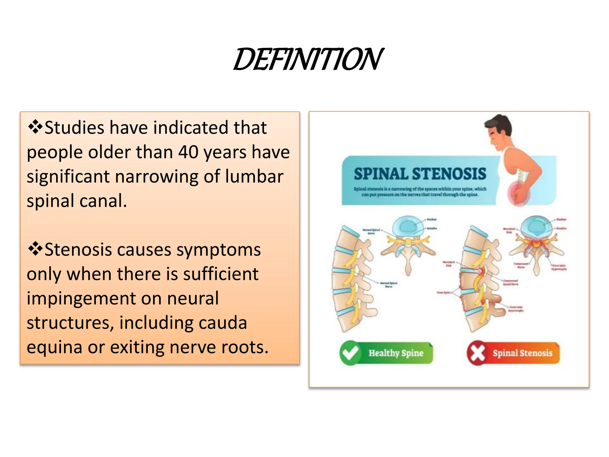 spinal canal stenosis.pptx definition, classification, pathophysiology ...