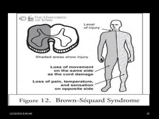 Spinal cord& its lesions,compressive myelopathy | PPT