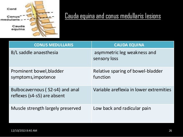 Conus Medullaris Cauda Equina Syndrome