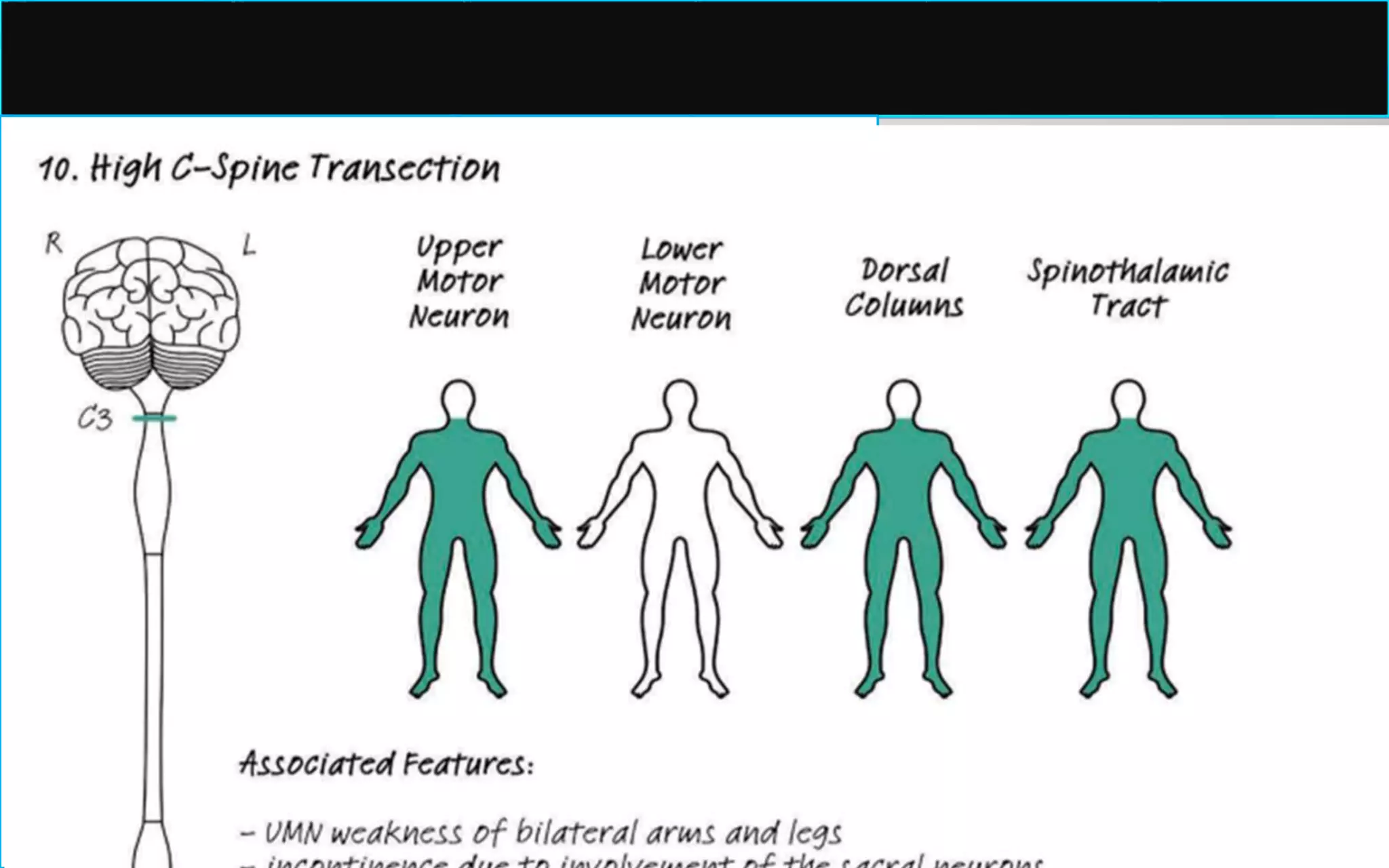 SPINAL CORD.pptx