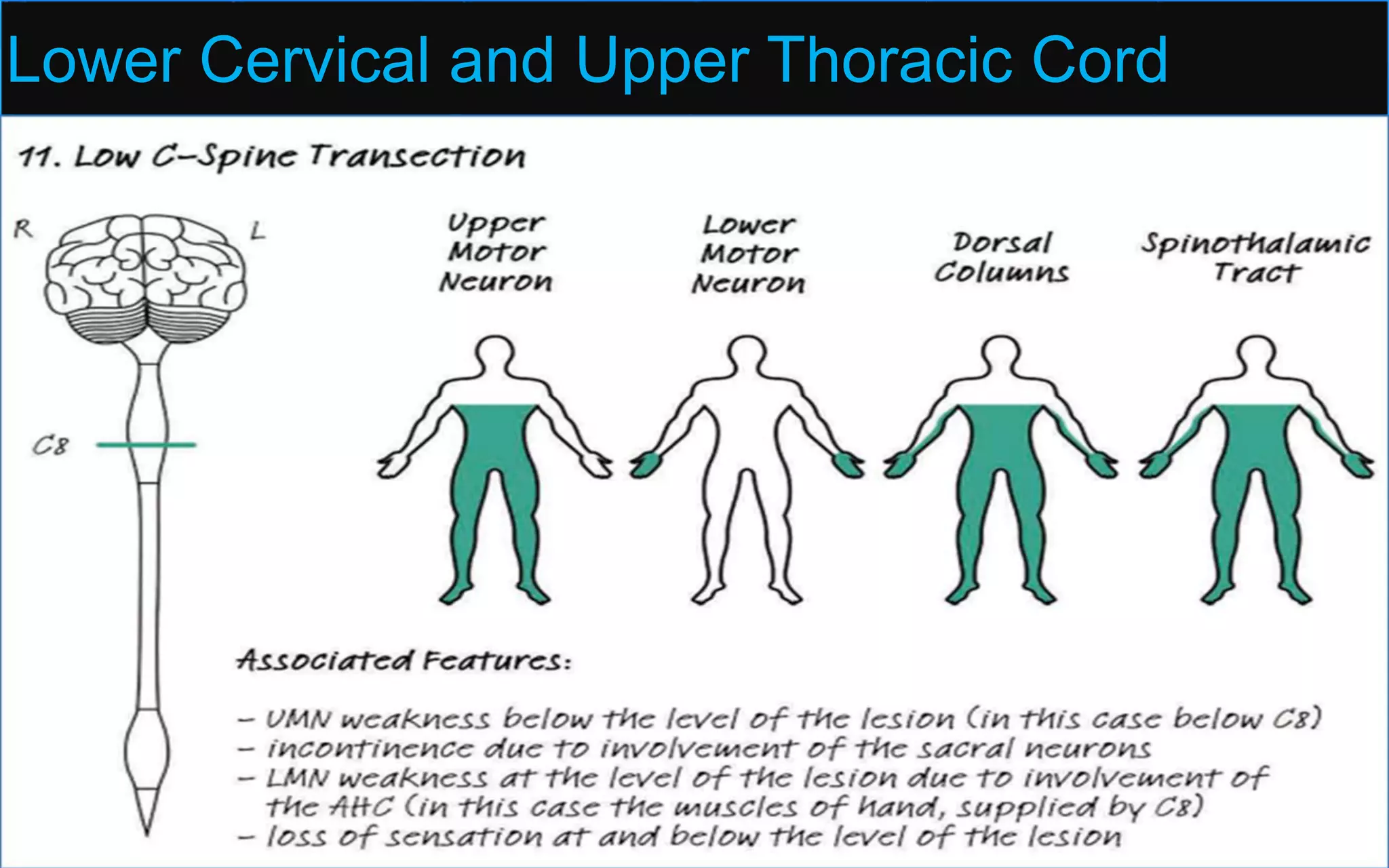 SPINAL CORD.pptx